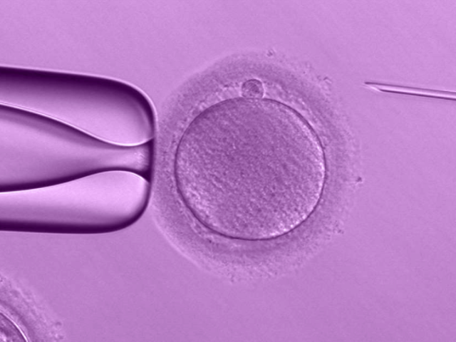 Blog: Laboratory Techniques in Assisted Reproduction | Ovolearning